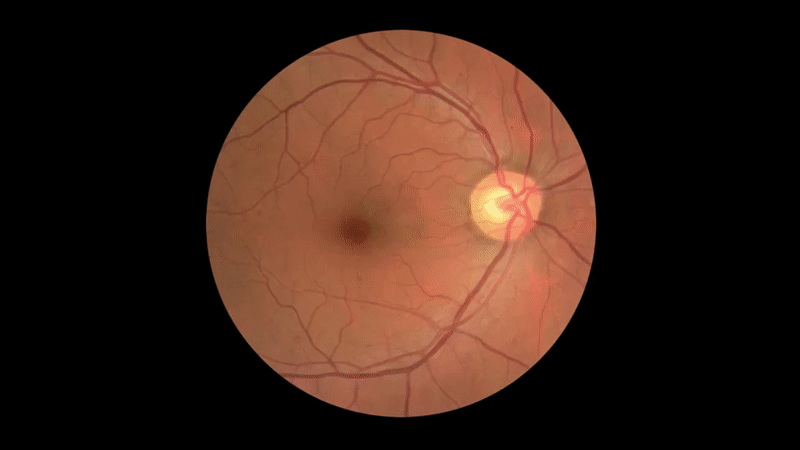 Google Health wants to speed up healthcare with machine learning and ...