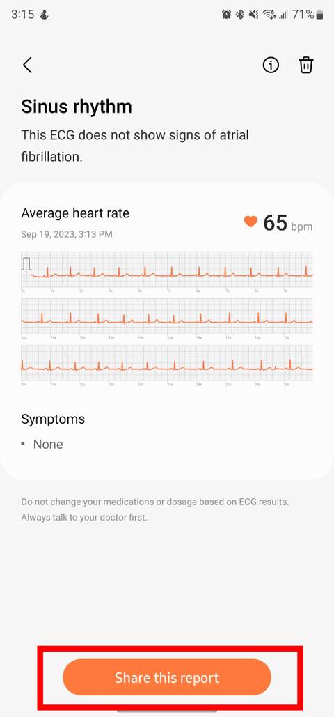 Samsung Galaxy Watch 6: How to set set up and use the ECG/EKG feature