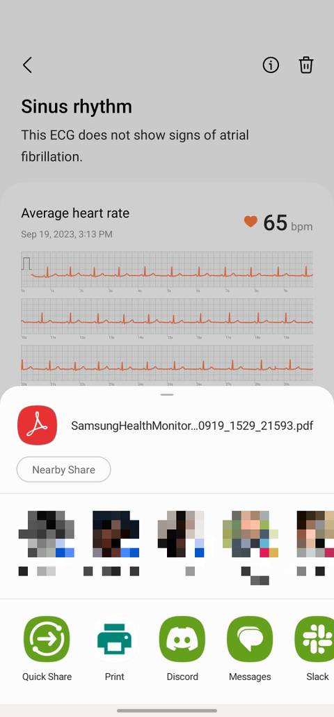 Samsung Galaxy Watch 6: How to set set up and use the ECG/EKG feature